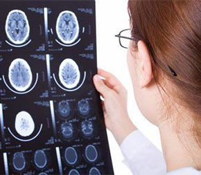 How to Become a Neuropsychologist (Program Requirements)